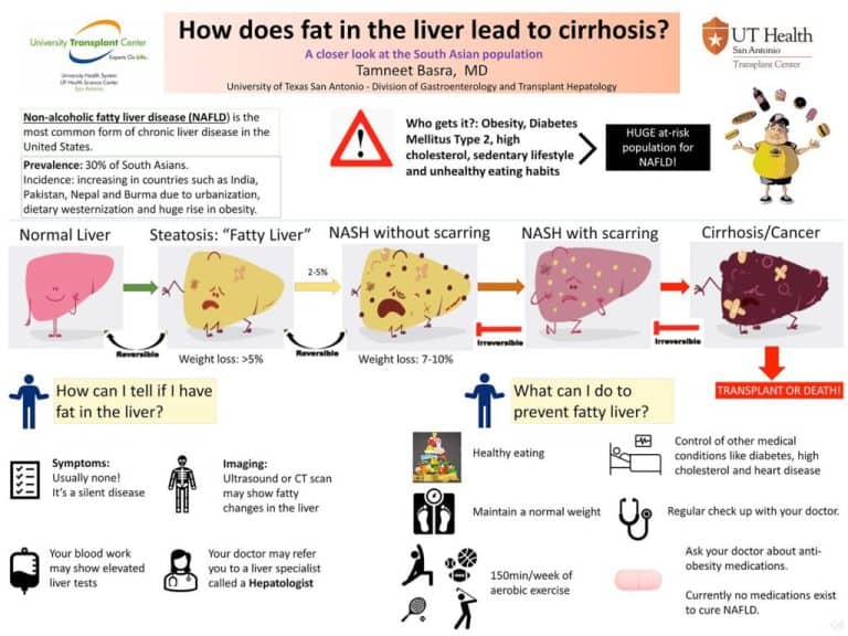How Does Fat in the Liver Lead to Cirrhosis? A Closer Look at the South ...