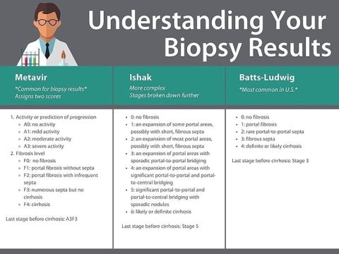 Fibrosis: Development