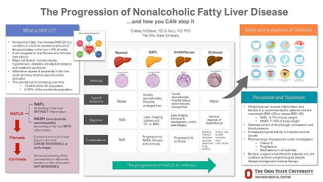 Nonalcoholic Fatty Liver Disease (NAFLD)